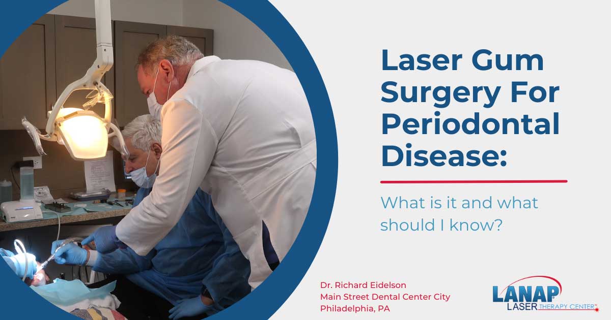 What to Know About Laser Gum Surgery for Periodontal Disease